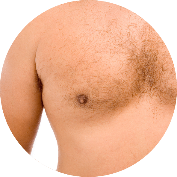 Zvětšení prsou - augmentace – ceny, typy implantátů | MyBestCare